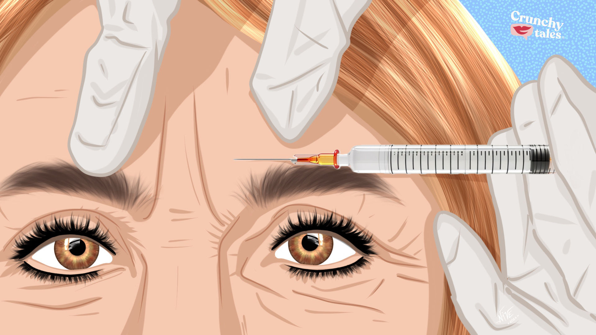 Botox or Notox? Why I've Embraced The Needle-Free Way